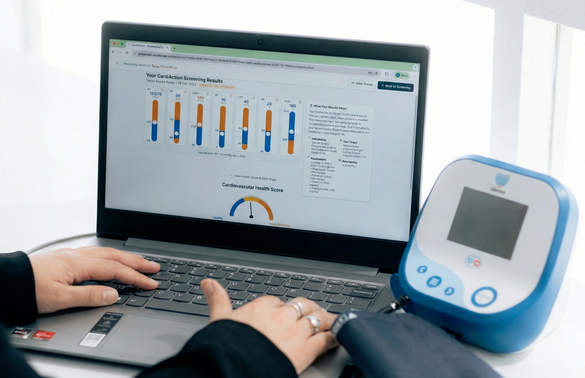 CardiAction screening results displayed on a laptop alongside the BP+ ...